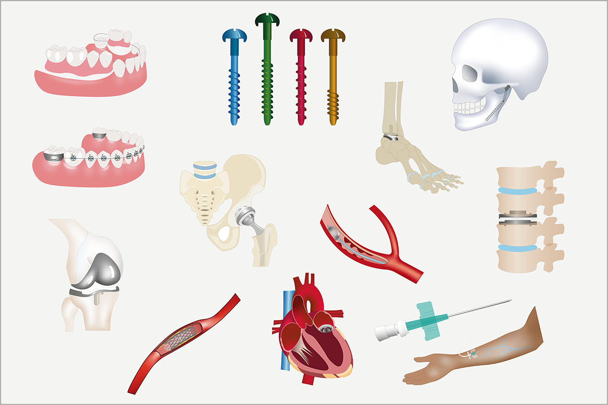 Paper: Medical Devices Database | Ansys