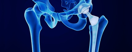 Explore the Important Challenges of Medical Device Design | Ansys