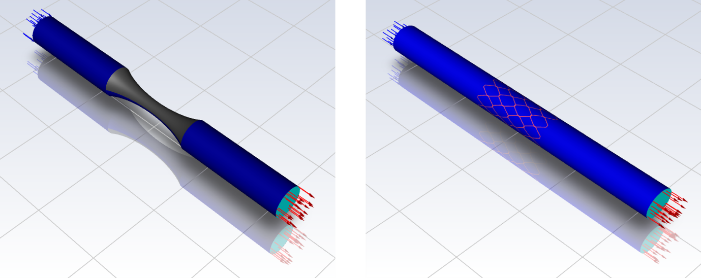 Coronary Stent Design with Ansys Tools | Education Resources
